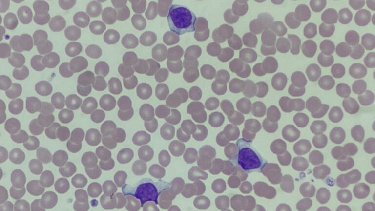 Infectious mononucleosis: when lymphocytes take centre stage – Only Cells