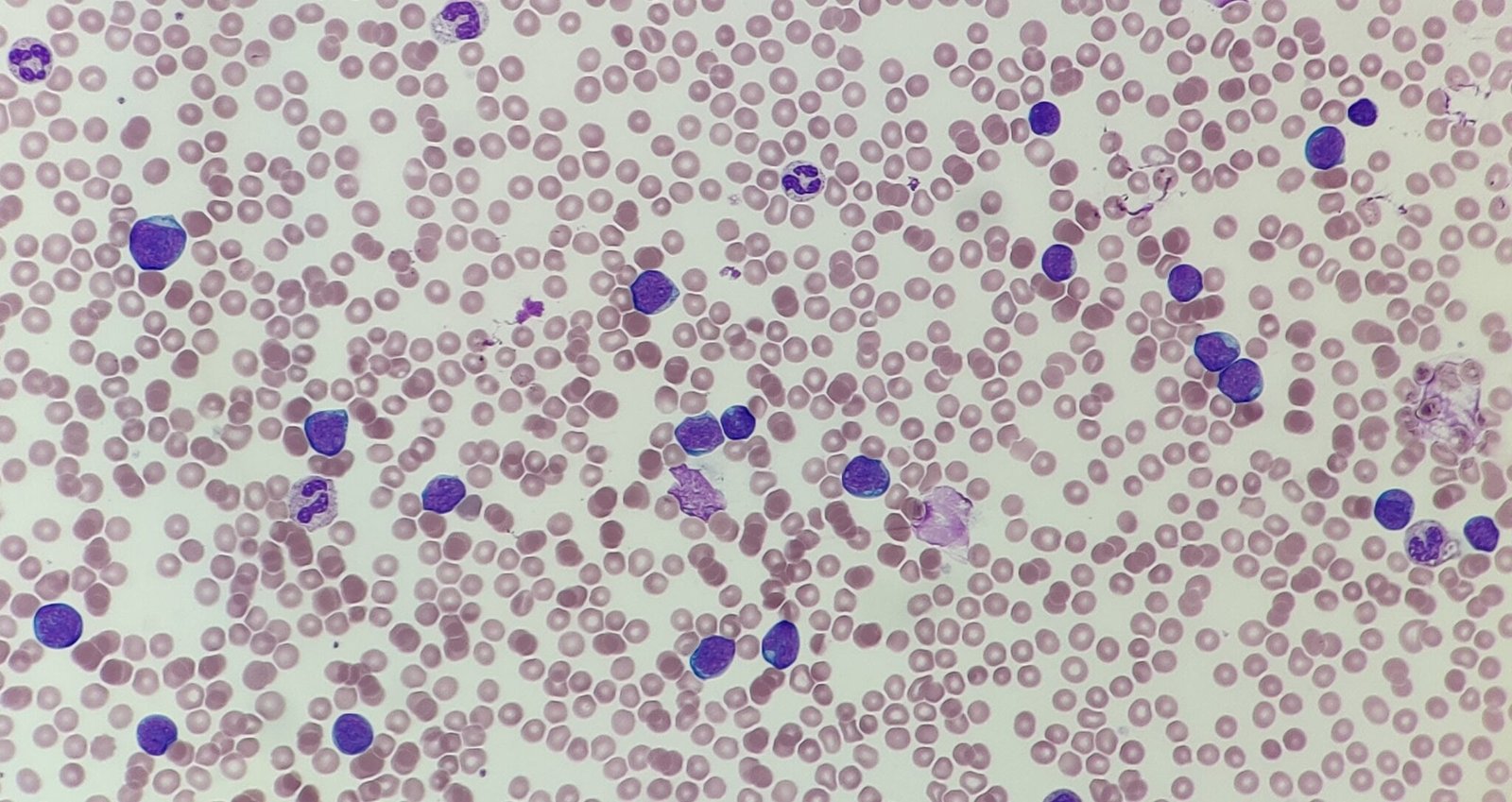 Morphology Monday | Case MM250721 – Only Cells