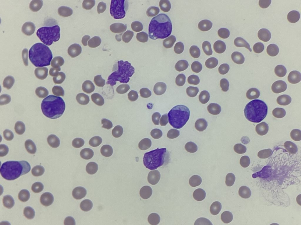 Smear cells – Only Cells