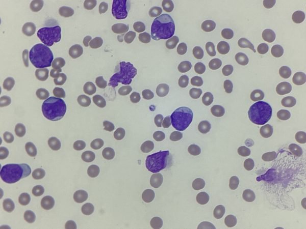 Smear cells – Only Cells
