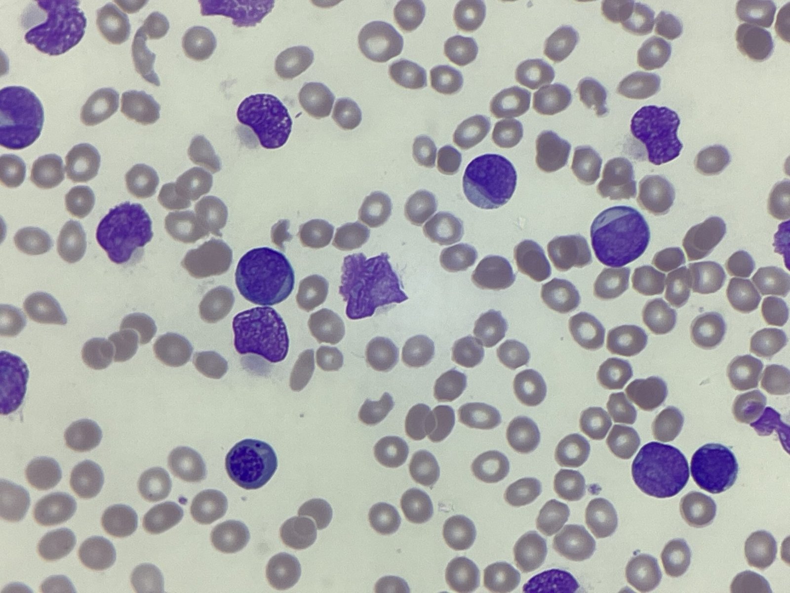 Smear cells – Only Cells