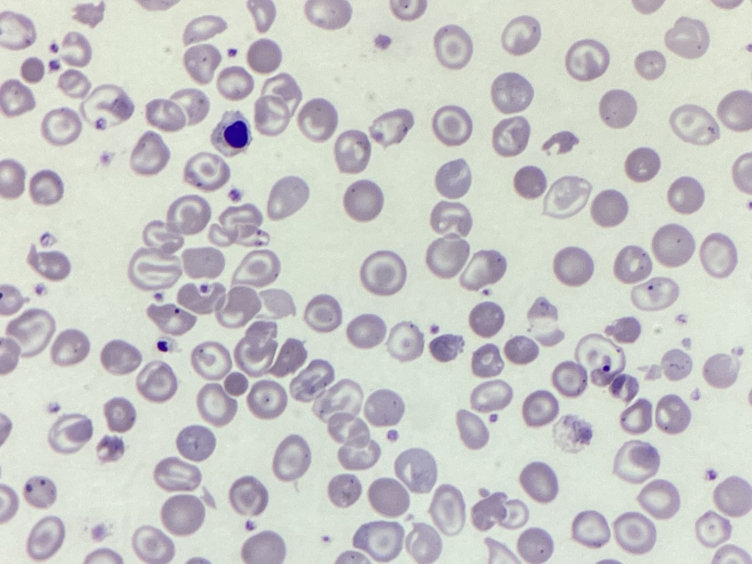 Red cells: Target cells – Only Cells