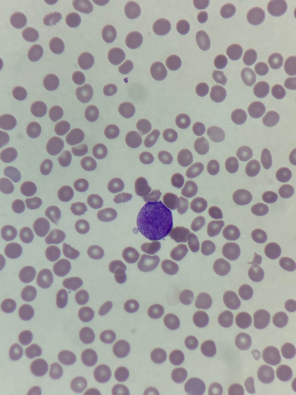 Morphology Monday | Case MM251013 – Only Cells
