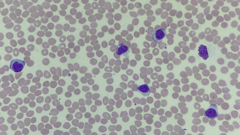 Infectious mononucleosis: when lymphocytes take centre stage – Only Cells