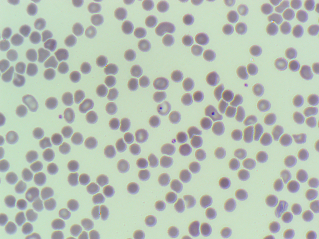 Red Cells: Howell-Jolly bodies – Only Cells
