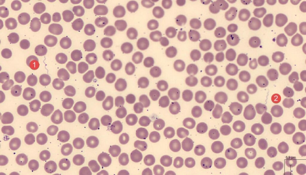 Wavy wonders: Borrelia’s appearance under the microscope – Only Cells