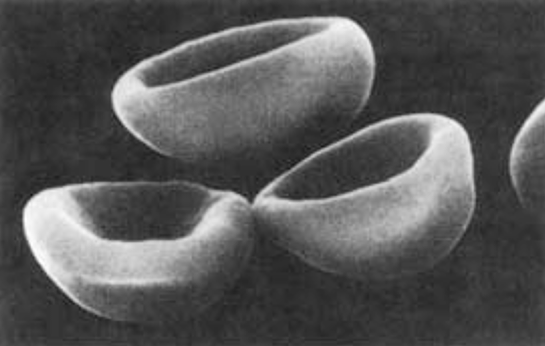 MM251201: Stomatocytes – Only Cells